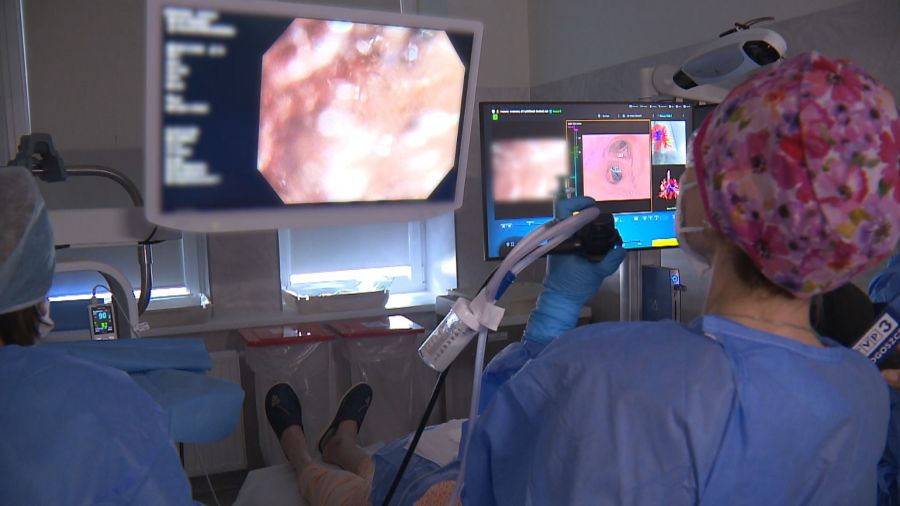 Bronchoskopia z nawigacją. Przełom w diagnostyce raka płuca w Kujawsko ...